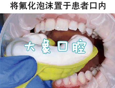 儿童门牙歪斜图片 儿童门牙长歪了图片 门牙歪斜图片 第3页 大山谷图库