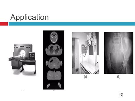 Presentation On Deformable Model For Medical Image Segmentation Ppt
