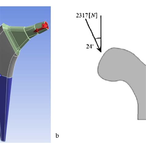 A Constraint And Loading Condition According To Astm F2996 13 B Download Scientific Diagram