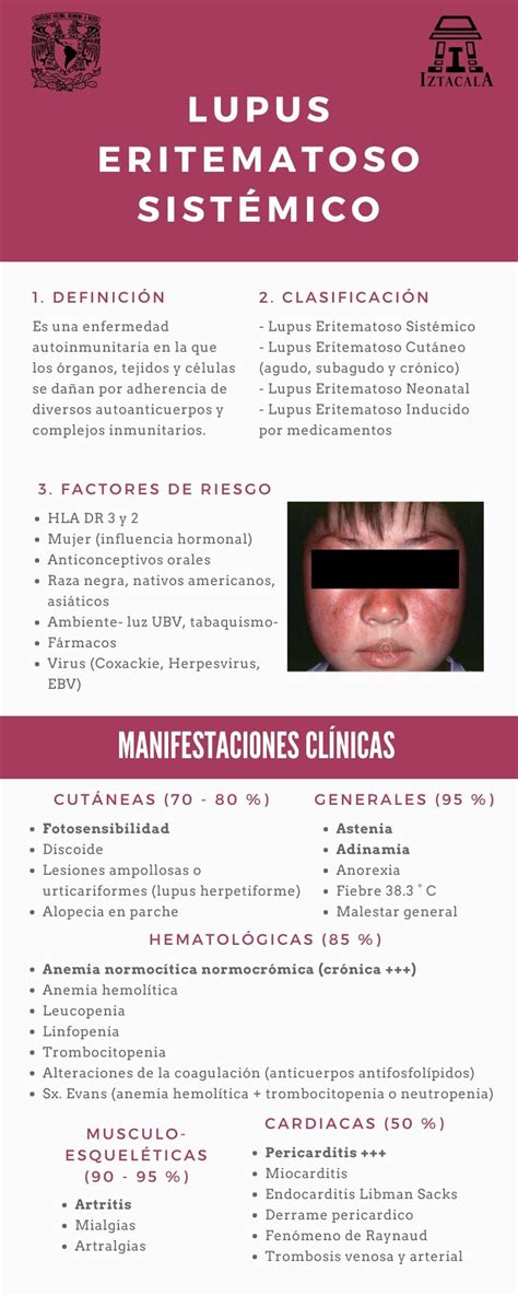 Lupus Eritematoso Sistemico