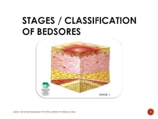 Bed Sores Pressure Ulcers Dr Rohit Bhaskar Pdf