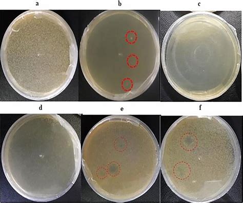 The Effect Of Bacteriophage Amount On The Growth Inhibition Of Li