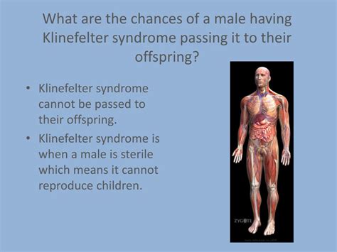 Klinefelter Syndrome Article Klinefelters Syndrome Xbpwf