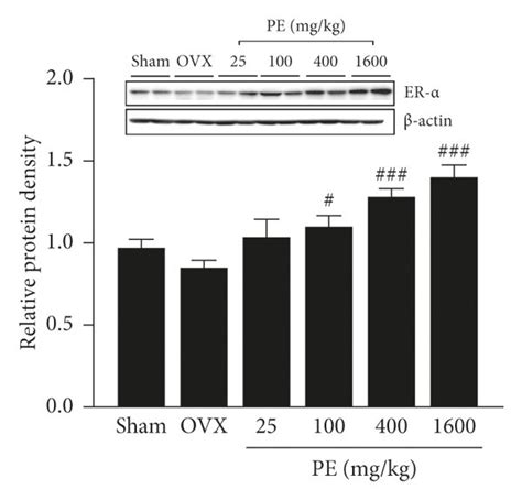 Effects Of Pe On A Femur Bone Mineral Density Bmd B Estradiol Download Scientific