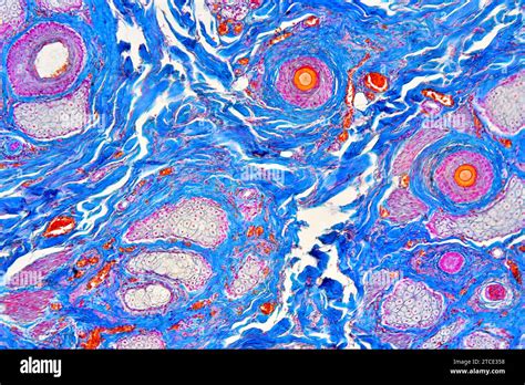 Human Scalp Cross Section Showing Hair Follicles Sebaceous Glands And Fibrous Tissue Optical
