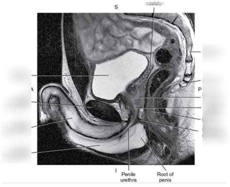 T2 Weighted Male Sagittal Slice Diagram Quizlet