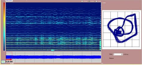 Print Of The Voice Analysis Software Screen With The Spectrogram Image