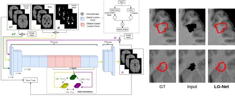 Deep Mri Synthesis