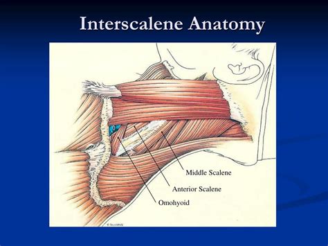 Interscalene Block Vertebral Artery At Hunter Wang Blog