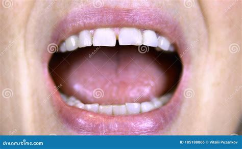 Anciana Muestra Dientes Los Dientes Superiores Están Rectos Y Los