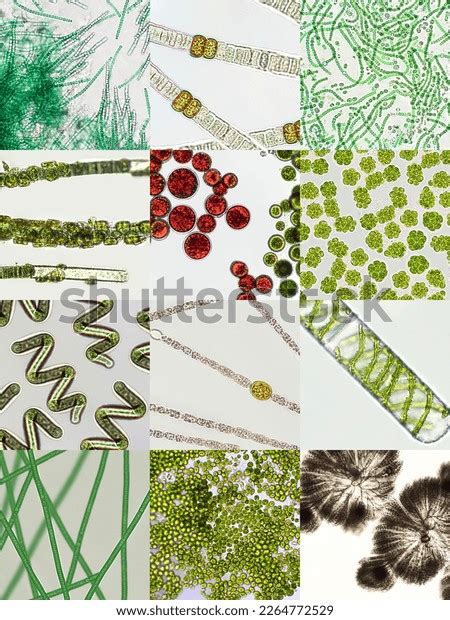 8 Microalgae Under Microscopic View Green Algae Cyanobacteria Phytoplankton Algae Mix Background
