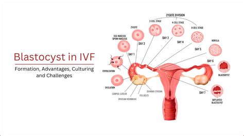 Blastocyst In Ivf Formation Culturing And Key Advantages