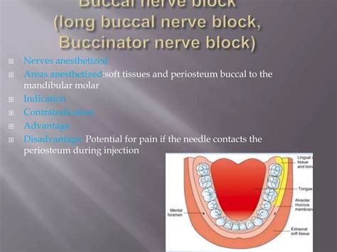 Mandibular Injection Techniques Pptx