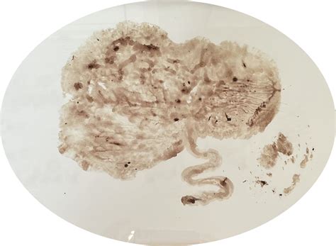 Paz Osteopathic Medicine Pllc Dr Sylvia Orozco Silberman