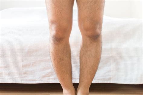 Causes And Treatments For Knock Knees Fortunate Feet