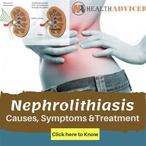 No Radiopaque Nephrolithiasis At Myra Christiano Blog