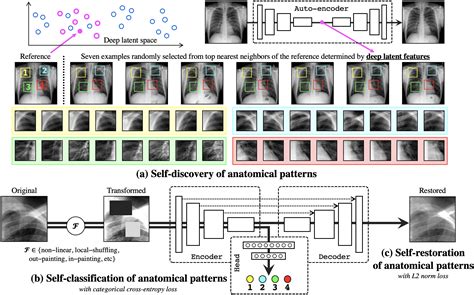 Steps In A Deep Learning Model Of Lung Nodule Detection At Carolyn Wilson Blog