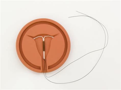Copper Iud And Periods At Kevin Blankenship Blog
