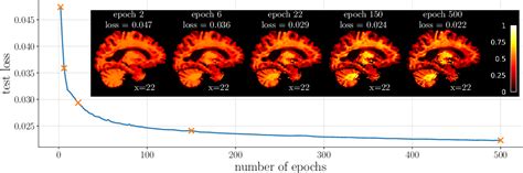figure 9 from a simulation driven supervised learning framework to estimate brain microstructure