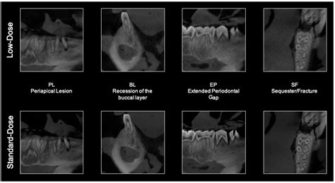 Cone Beam Volumetric Imaging Dental The Best Picture Of Beam