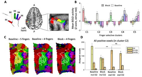 Single Finger Nerve Block Attenuates D2 Activity But Does Not Cause Download Scientific Diagram