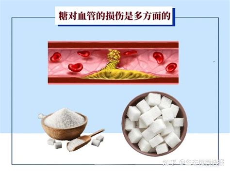 维兰尼健康科普：血管堵塞是什么原因造成的？ 知乎