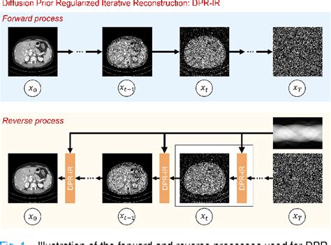 Figure 1 From Diffusion Prior Regularized Iterative Reconstruction For Low Dose Ct Semantic