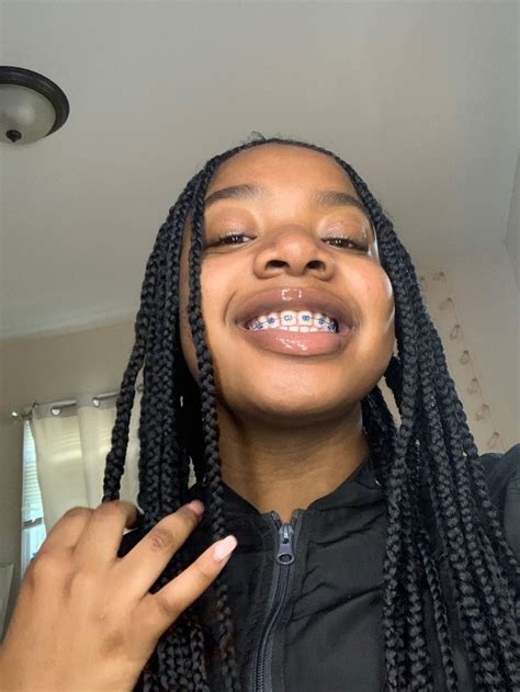 Braces Teeth Colors Cute Braces Colors Teeth Braces Cute Girls With