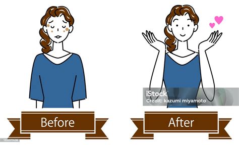 스킨 케어 얼굴 피부 문제 반점과 합리적인 안료 반점 피부 관리 얼굴 피부 문제에 의해 귀여운 여성 일러스트 벡터 전후 반점 노인 색소 병변 전후 예쁜 아가씨 간단한