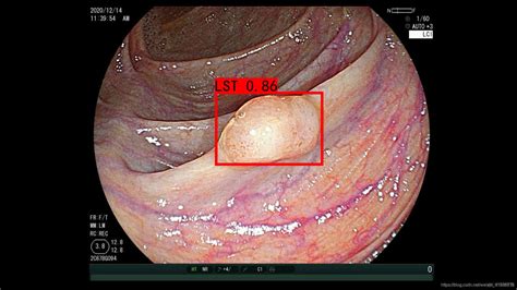 Pytorch Mask Rcnn训练自己的数据集 Pytorch Ssd训练自己的数据集mob64ca140651e5的技术博客51cto博客