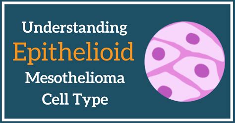 Epithelioid Mesothelioma Treatments Symptoms And Prognosis