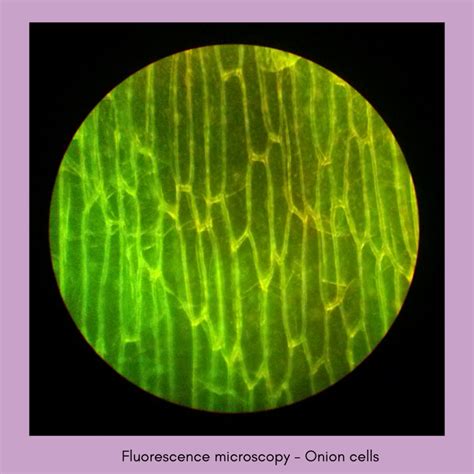 Fluorescence Microscopy My Biology Dictionary