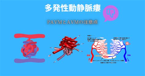 多発性肺動静脈瘻（pavm）と感染症：オスラー病患者におけるリスクと注意点 オスラー病患者会
