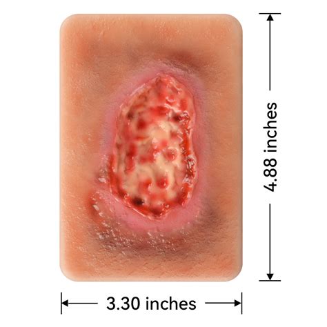 Necrotic Tissue Wound Simulation Model Set Medarchitect