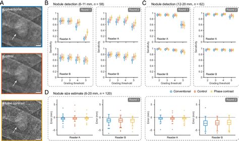Edge Enhancement Does Not Improve Pulmonary Nodule Detection A