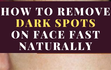 How To Remove Dark Spots On Face Fast Naturally SKINCARE