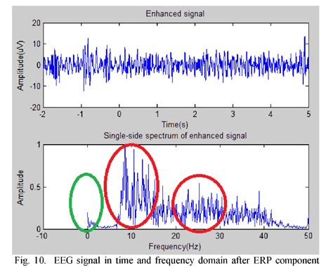 Figure 10 From Optimal Eeg Feature Selection By Genetic Algorithm For
