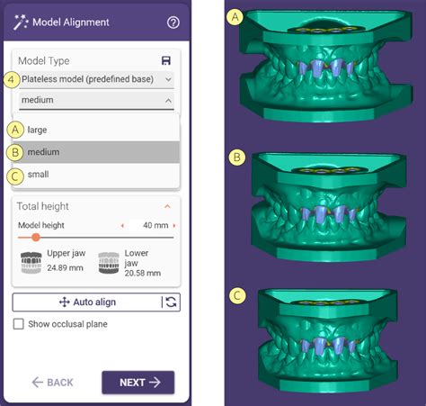 Model Creator Module Exocad