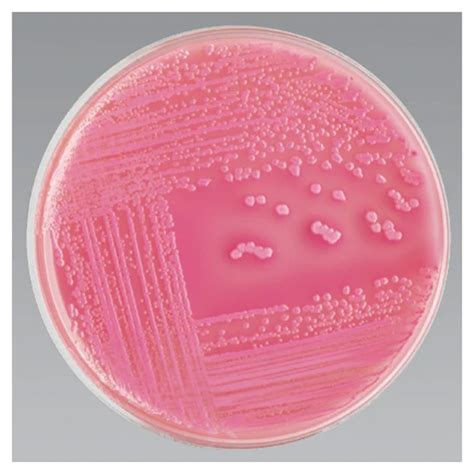 Salmonella Shigella Emb Shigella Flexneri Salmonella Typhimurium On