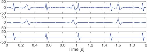 Figure 1 From Sparse Representation For Fetal Qrs Detection In