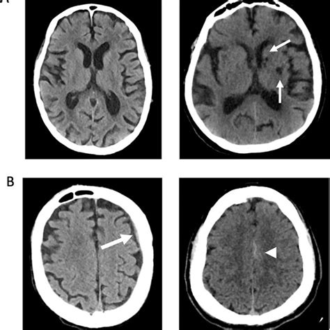 Ic Cases A Examples Of True Negative Ic Cases The Left Panel Shows A Download Scientific