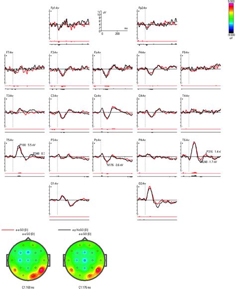 QEEG Brain Mapping Restore Behavioral Health