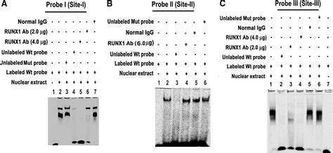 Platelet Protein Kinase C θ Deficiency With Human Runx1 Mutation Arteriosclerosis Thrombosis