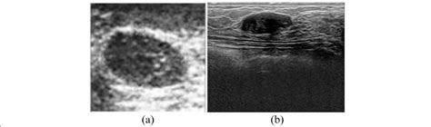 A Example Of A Cropped Image From Dataset A And B Example Of Original Download Scientific