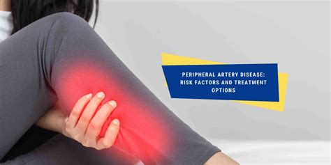 Peripheral Artery Disease Risk Factors And Treatment Options