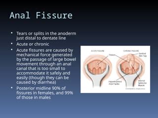 Benign Rectal Anal And Perinial Problemsppt