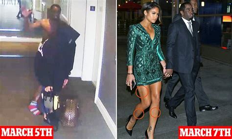 Cassie Is Seen With Multiple Bruises Two Days After Diddy Hotel Beating