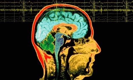 Brain Scan Eeg Leaceto