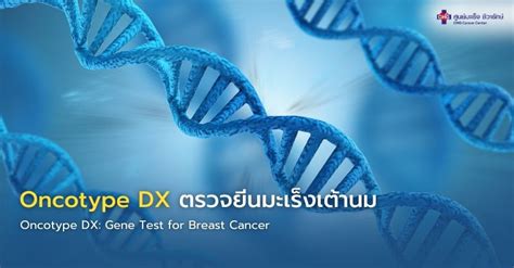 Oncotype Dx ตรวจยีนมะเร็งเต้านม ศูนย์ชีวารักษ์