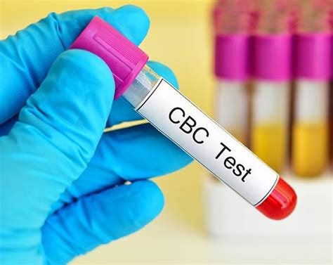 Complete Blood Count CBC Normal Ranges Test Details
